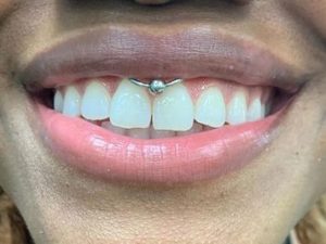 Smiley Piercing 50 Image Ideas jewelry, pros & cons, design & care ...
