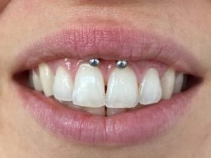 Smiley Piercing 50 Image Ideas jewelry, pros & cons, design & care ...