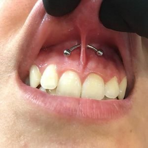 Smiley Piercing 50 Image Ideas jewelry, pros & cons, design & care ...